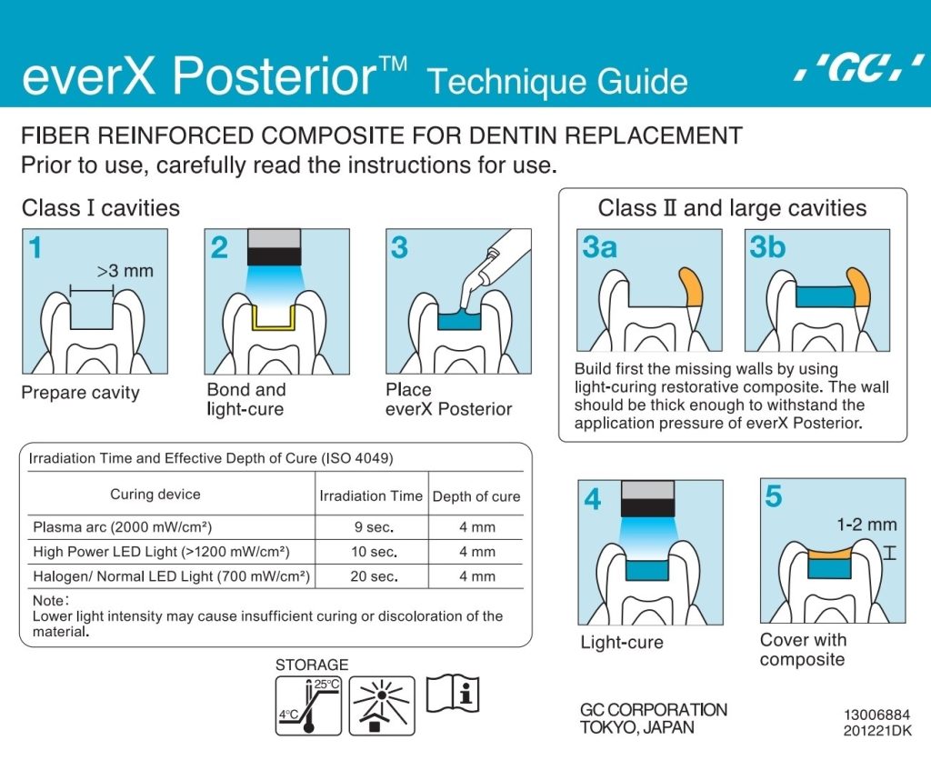 GC EverX posterior - Future Dentist