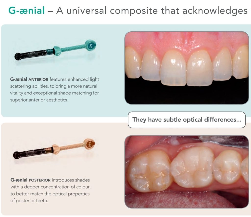 GC G-Aenial Anterior & Posterior - Future Dentist